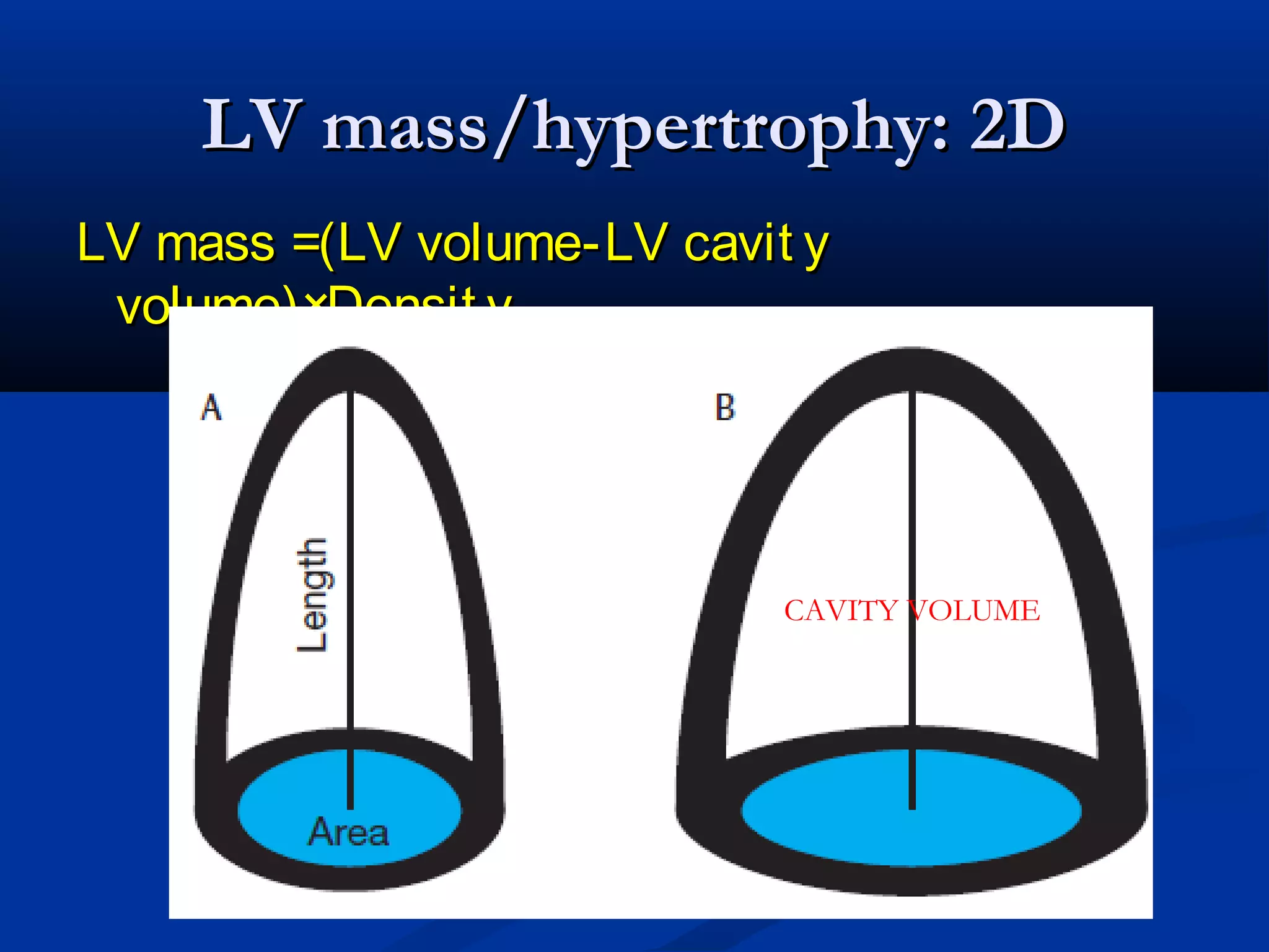 Echocardiographic evaluation of lv function | PPT