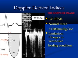 Echocardiographic evaluation of lv function | PPT