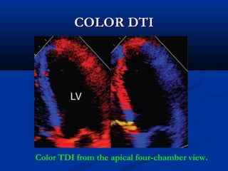 Echocardiographic evaluation of lv function | PPT