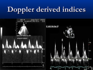 Echocardiographic evaluation of lv function | PPT