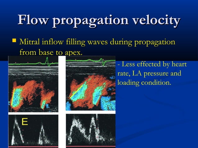 Echocardiographic evaluation of lv function | PPT