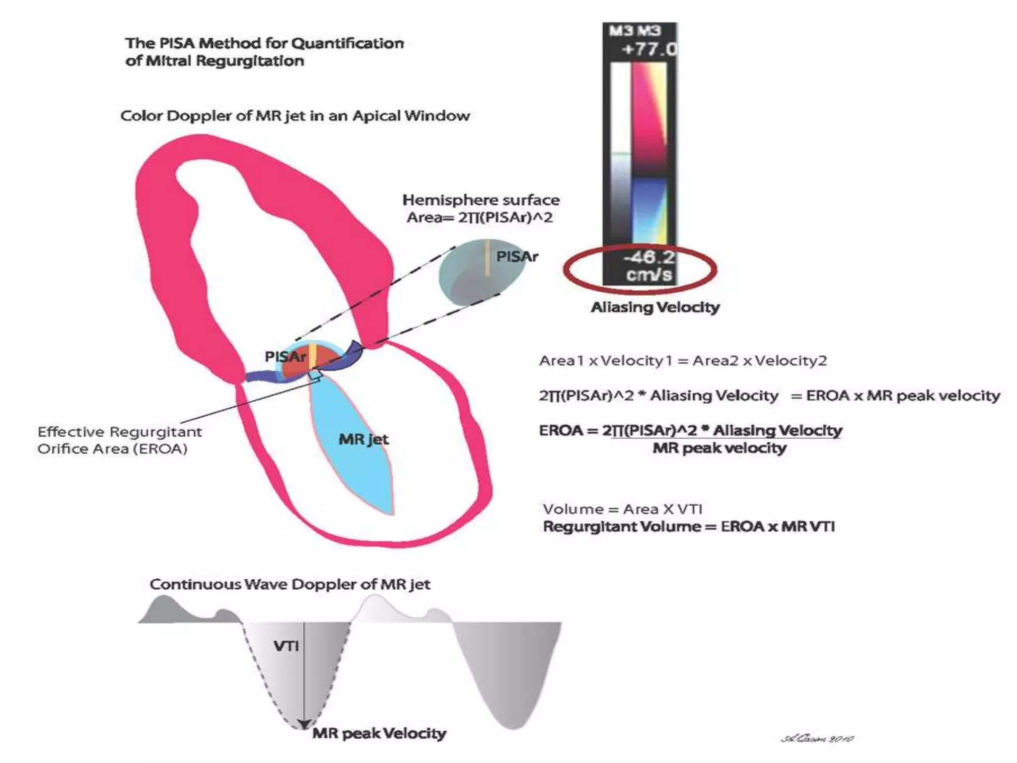 Echocardiographic evaluation of mitral regurgitation | PPTX