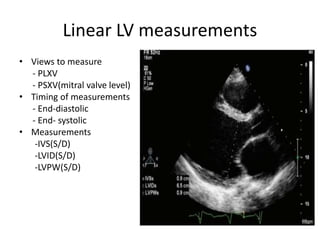 Echocardiographic measurements | PPTX