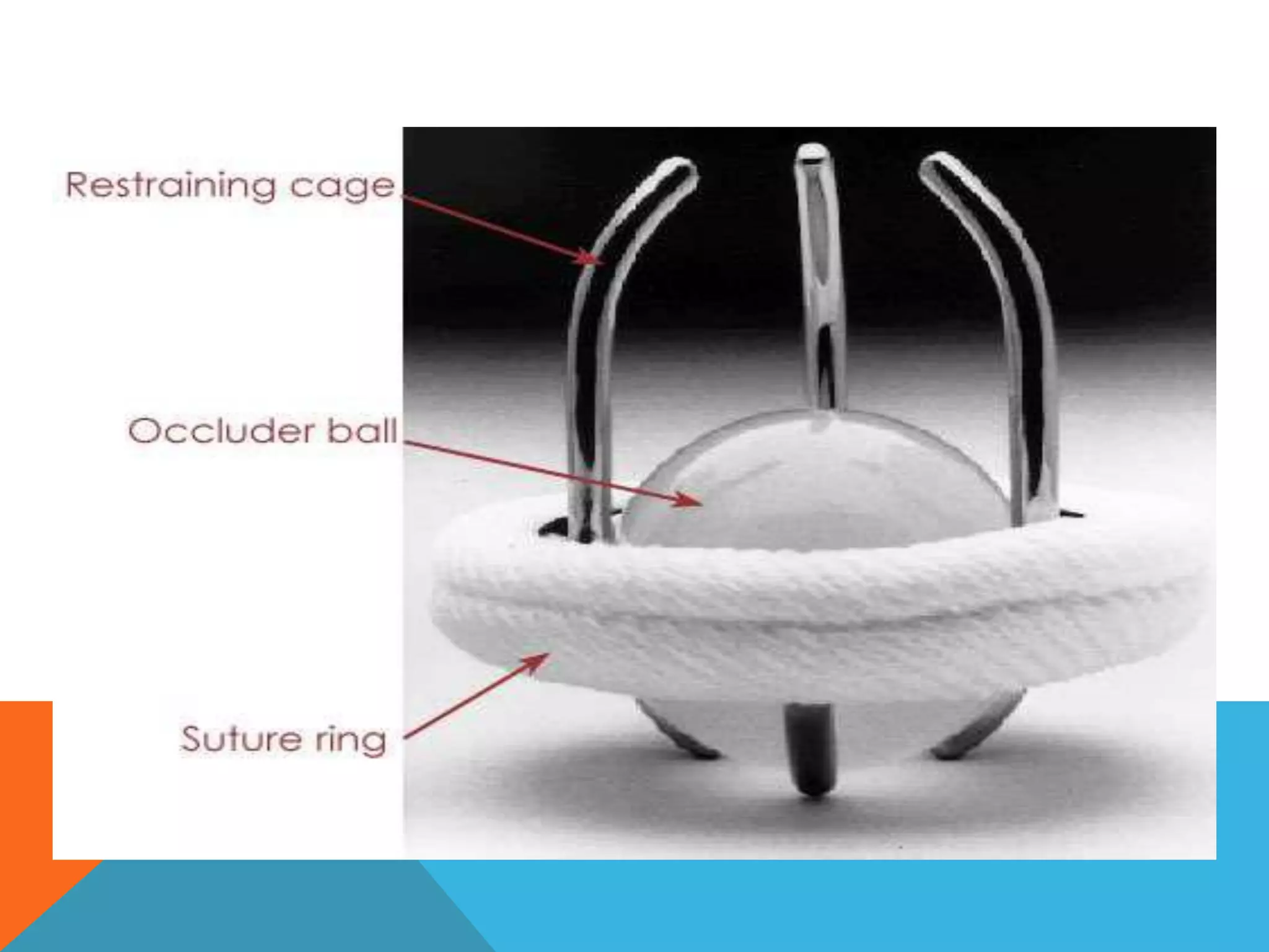 Echocardiographic recognition, function and dysfunction of prosthetic ...
