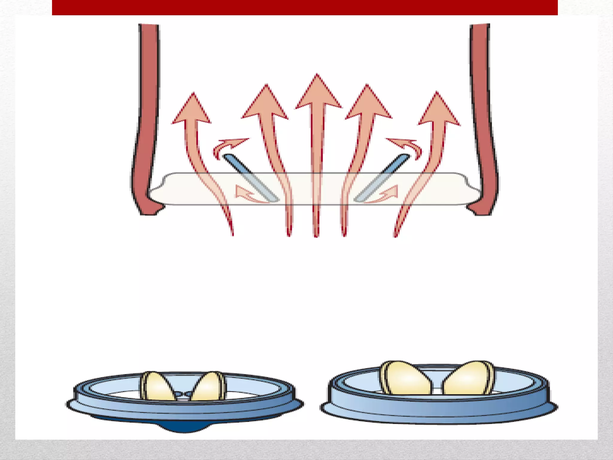 Echocardiographic recognition, function and dysfunction of prosthetic ...