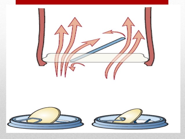 Echocardiographic recognition, function and dysfunction of prosthetic ...