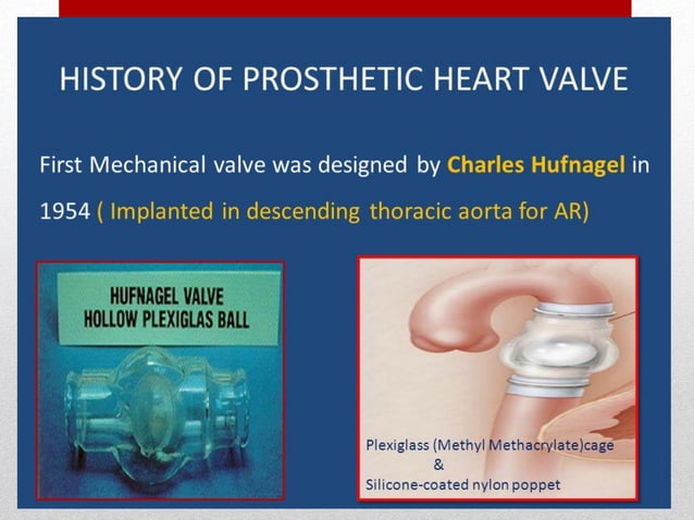 Echocardiographic recognition, function and dysfunction of prosthetic ...