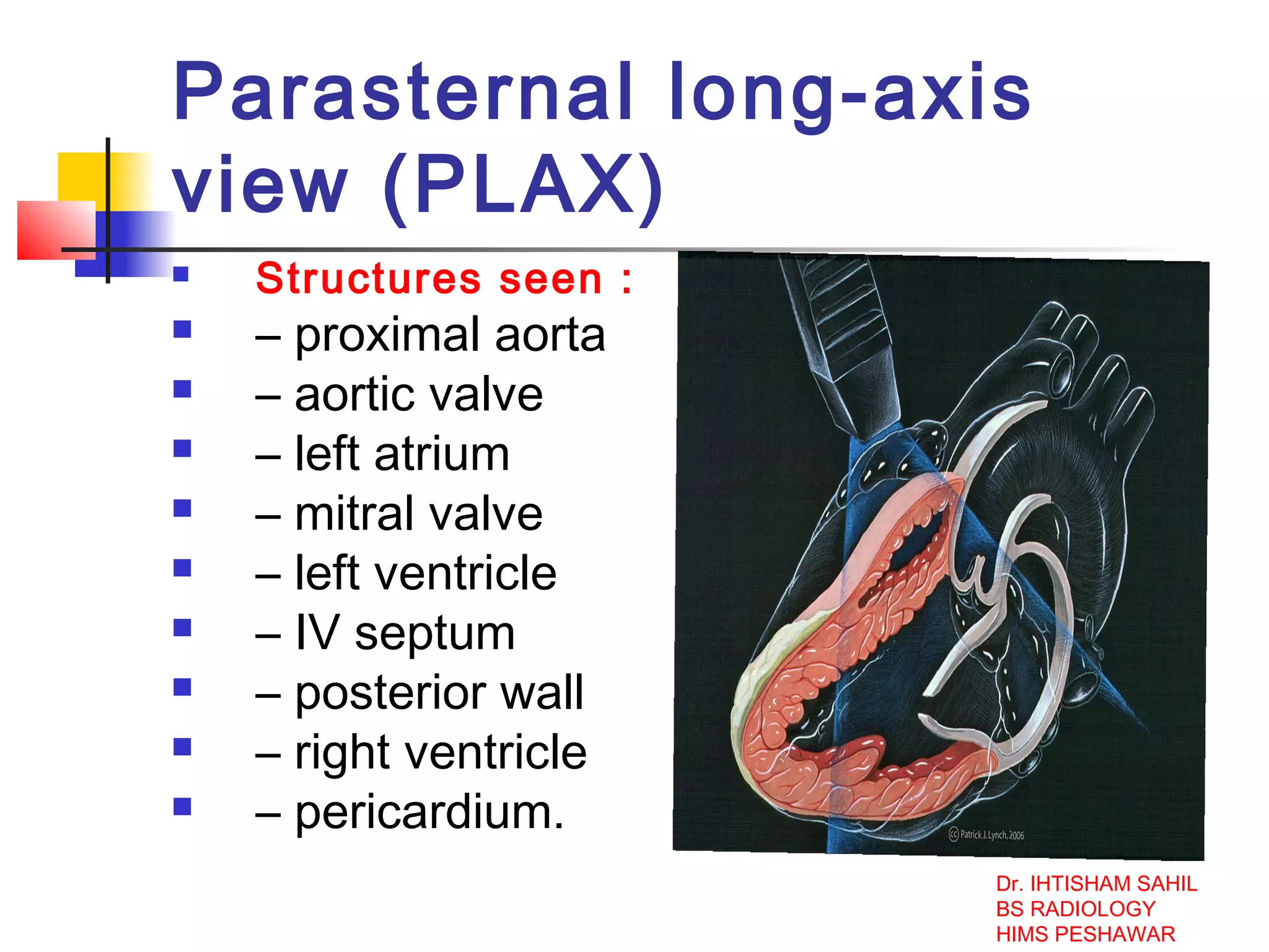 Echocardiography | PPT