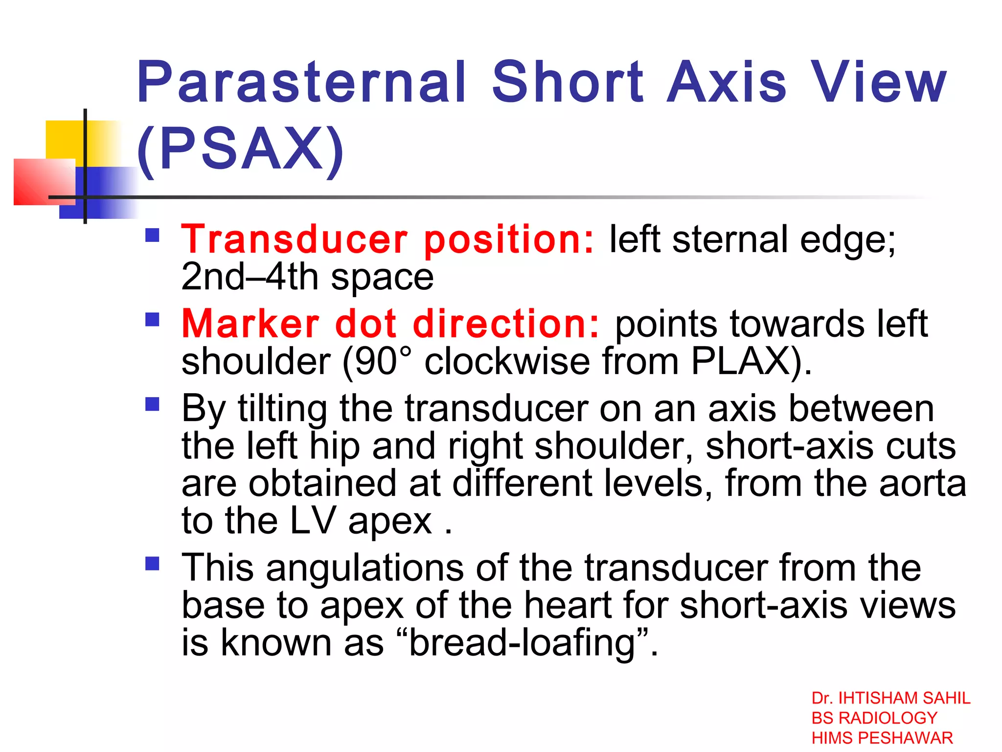 Echocardiography | PPT