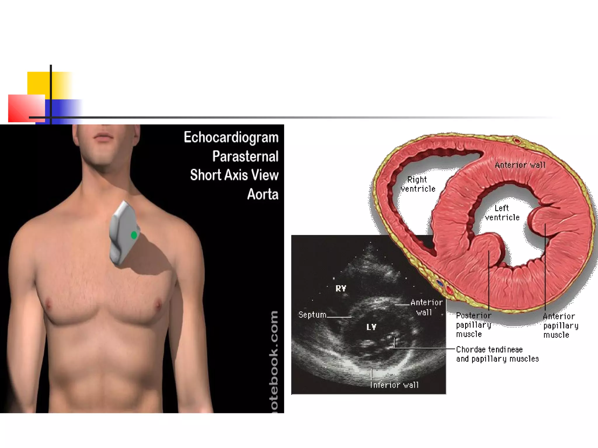 Echocardiography | PPT