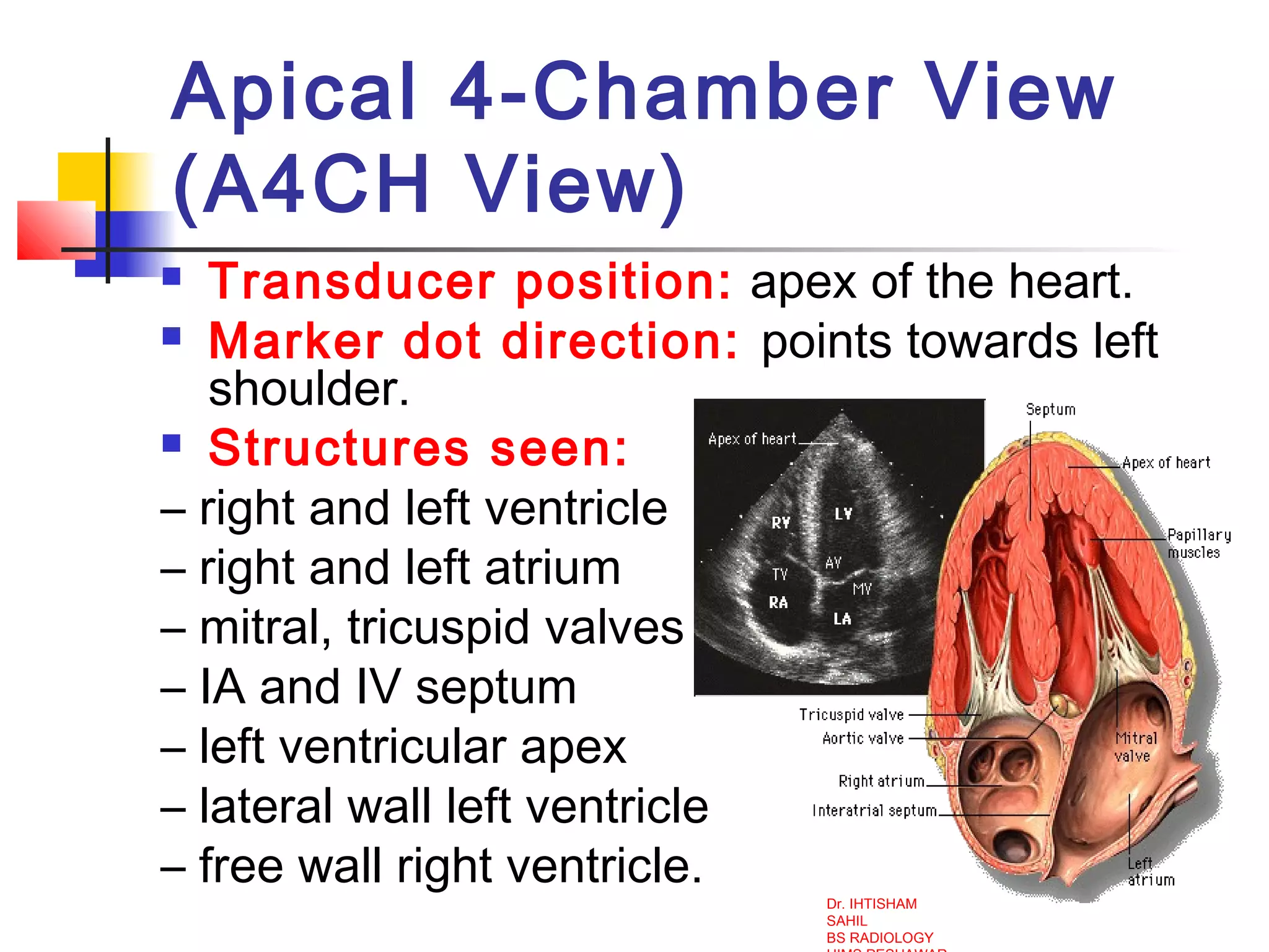 Echocardiography | PPT