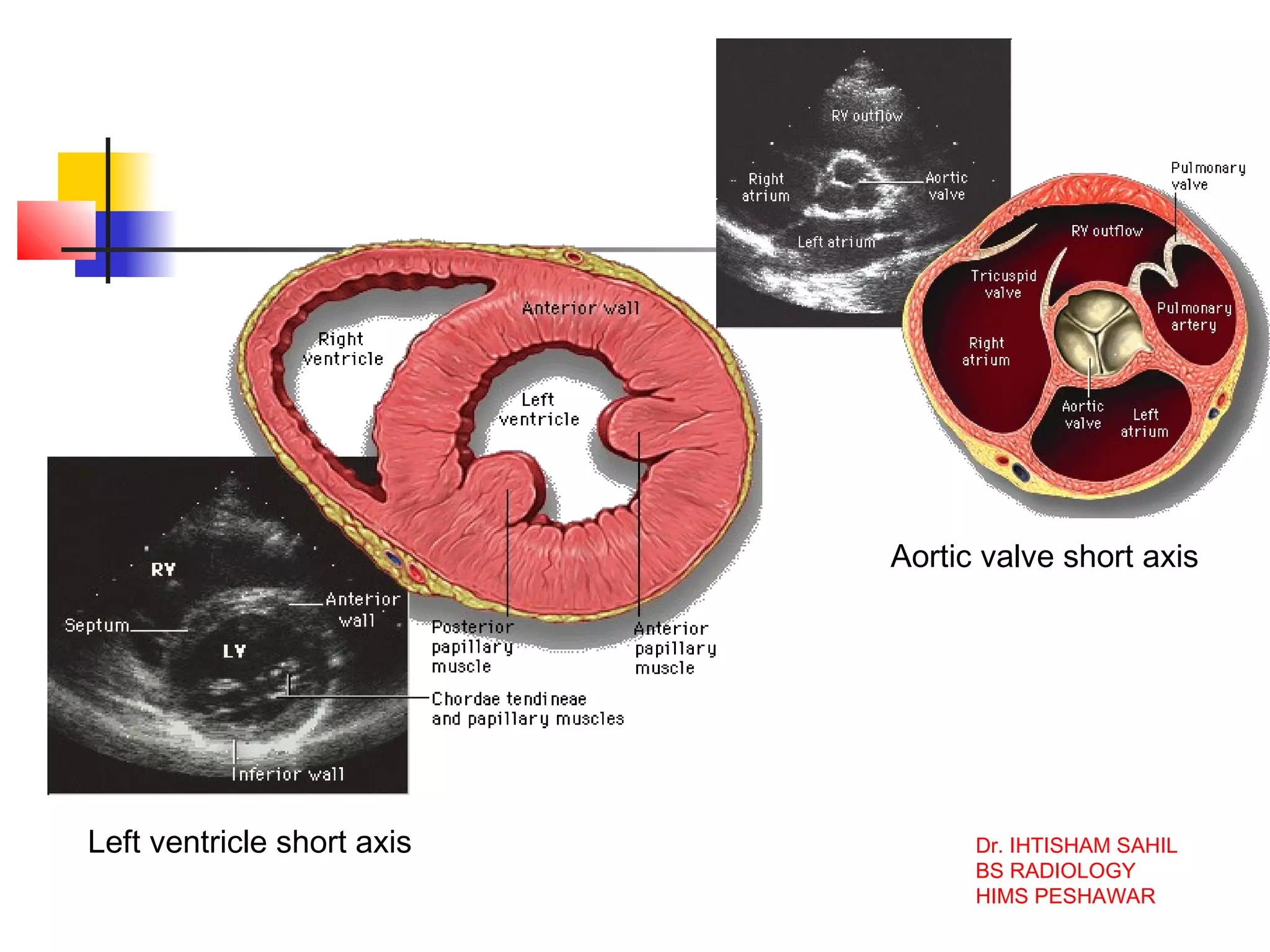 Echocardiography | PPT