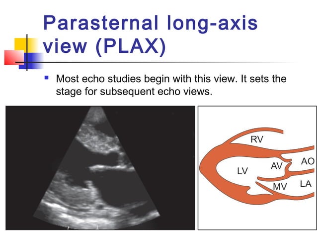 Echocardiography | PPT