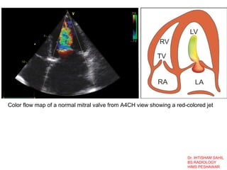 Echocardiography | PPT