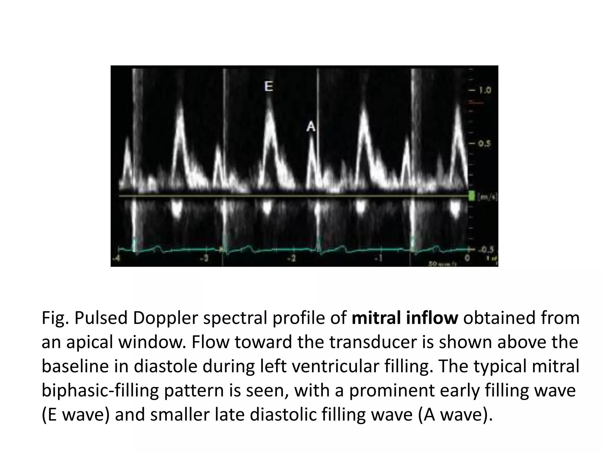 Echocardiography | PPTX