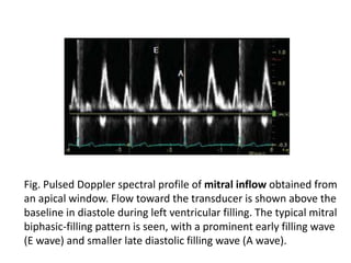 Echocardiography | PPTX