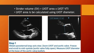 Echocardiography | PPTX