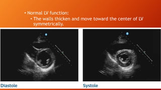 Echocardiography | PPTX