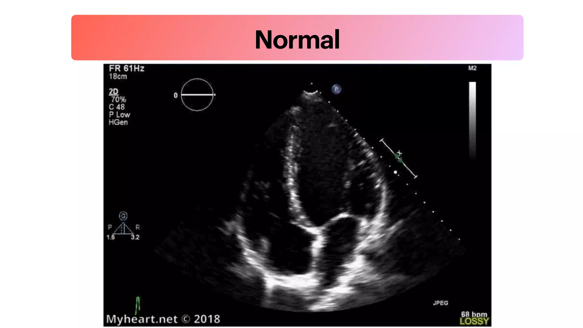 Echocardiography.pdf