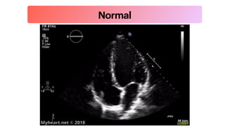 Echocardiography.pdf