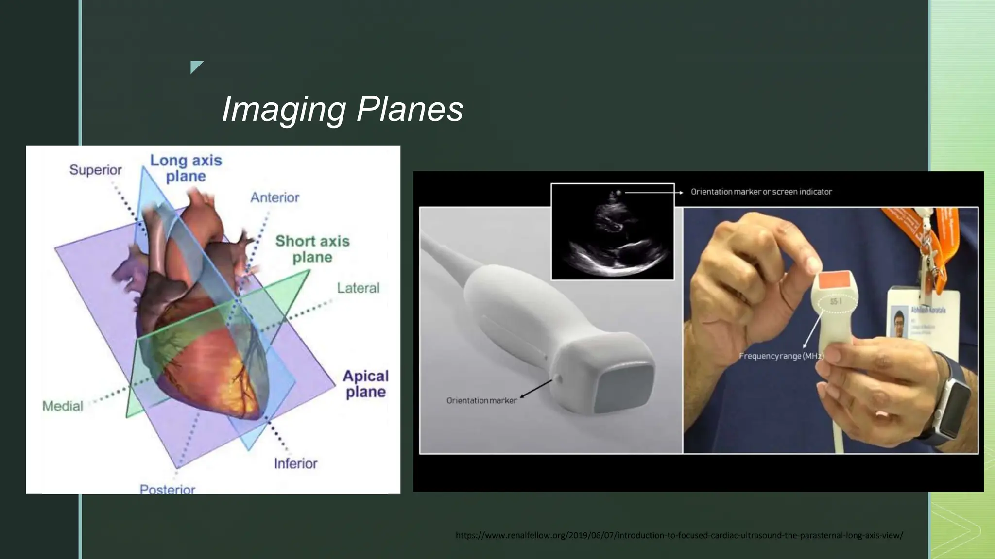 Echocardiography.pptx DATA ECHO BELAJAR ECHO | PPTX | Heart and Cardiovascular Diseases ...