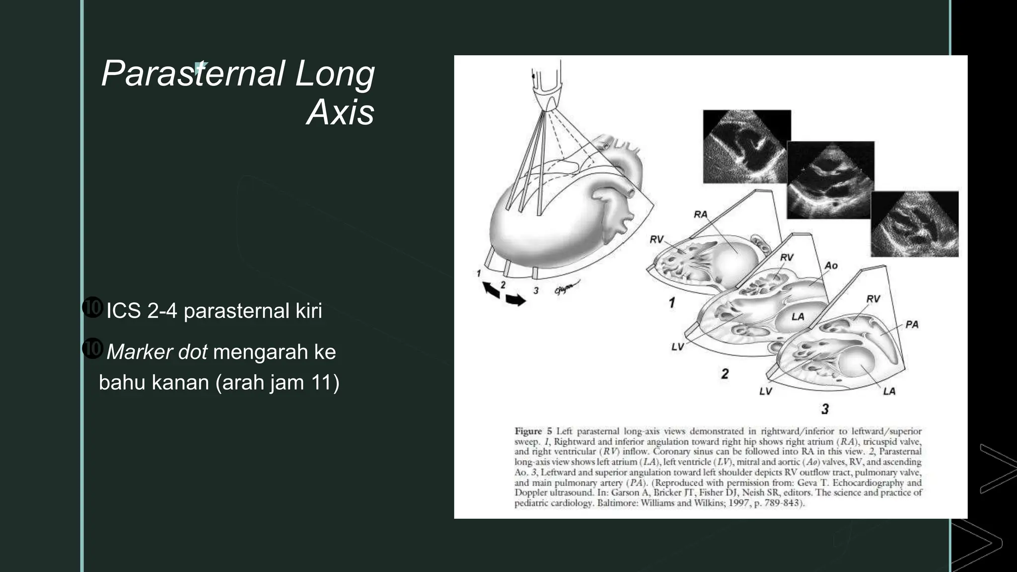 Echocardiography.pptx DATA ECHO BELAJAR ECHO | PPTX | Heart and Cardiovascular Diseases ...