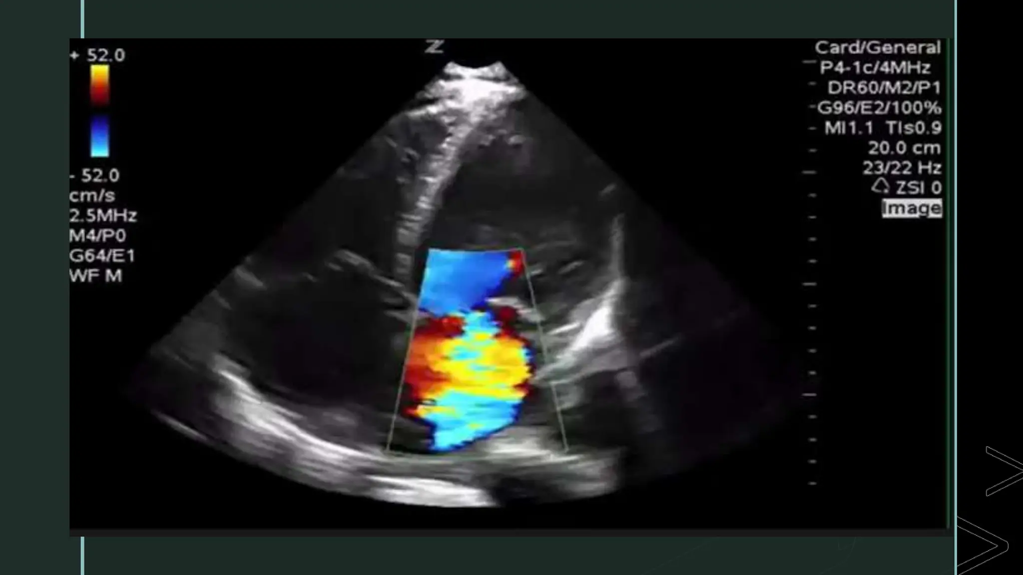 Echocardiography.pptx DATA ECHO BELAJAR ECHO | PPTX | Heart and ...