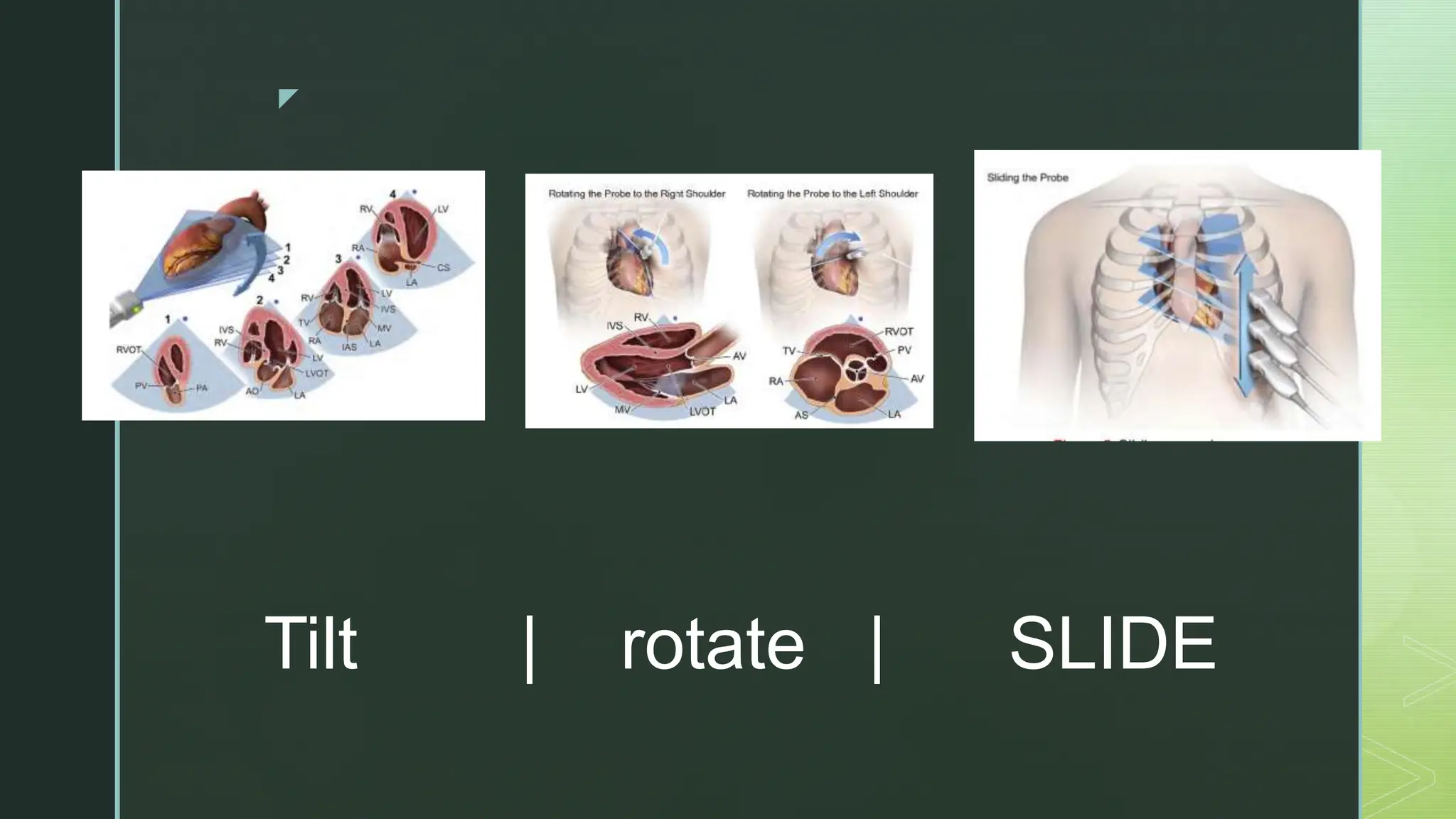 Echocardiography.pptx DATA ECHO BELAJAR ECHO | PPTX | Heart and Cardiovascular Diseases ...