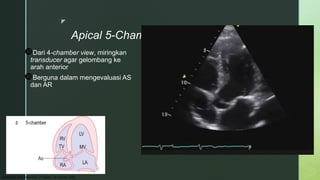 Echocardiography.pptx DATA ECHO BELAJAR ECHO | PPTX
