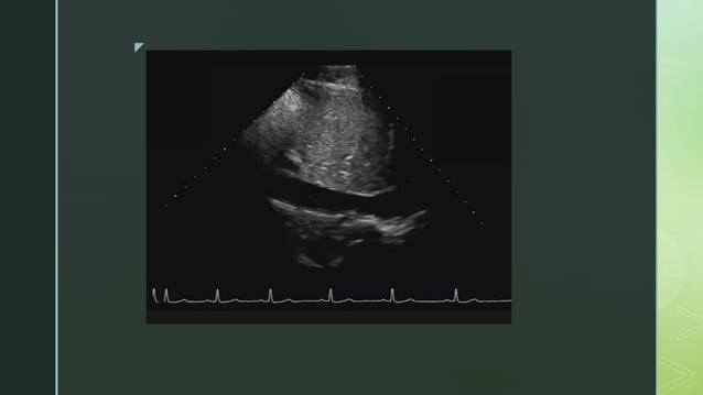 Echocardiography.pptx DATA ECHO BELAJAR ECHO | PPTX | Heart and ...