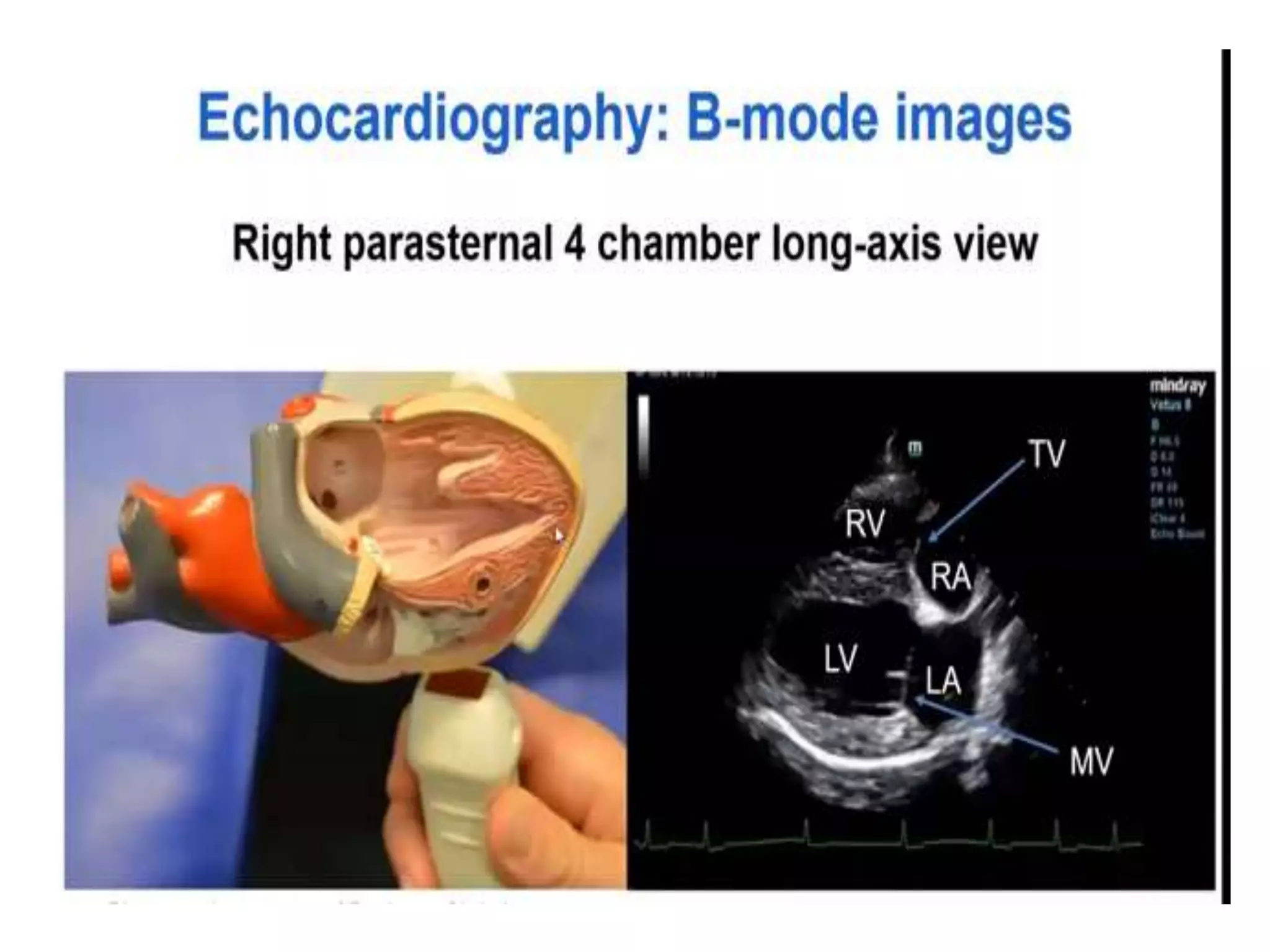 Canine Echocardiography -Dr Venkatesh S M.pptx