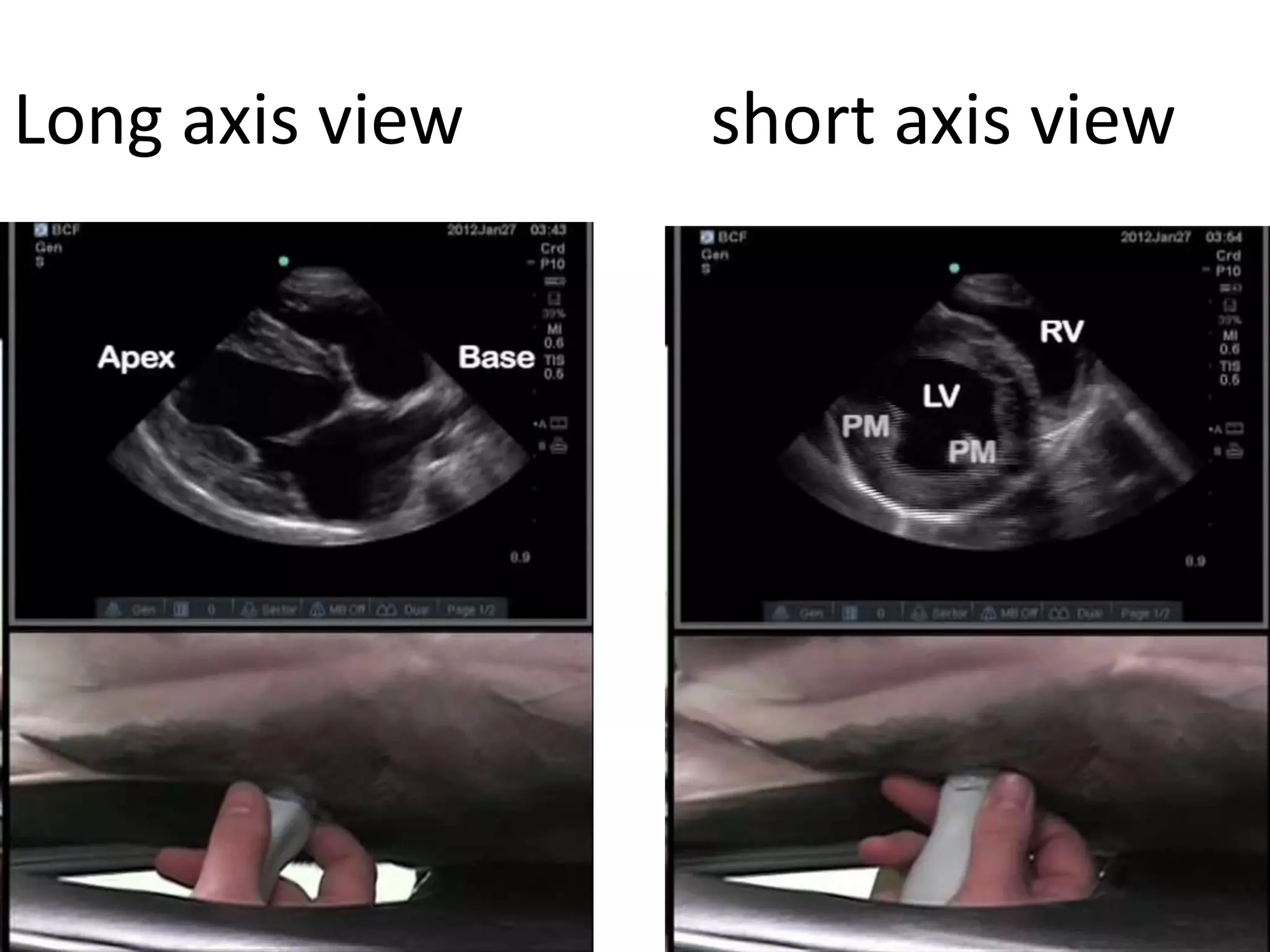Canine Echocardiography -Dr Venkatesh S M.pptx