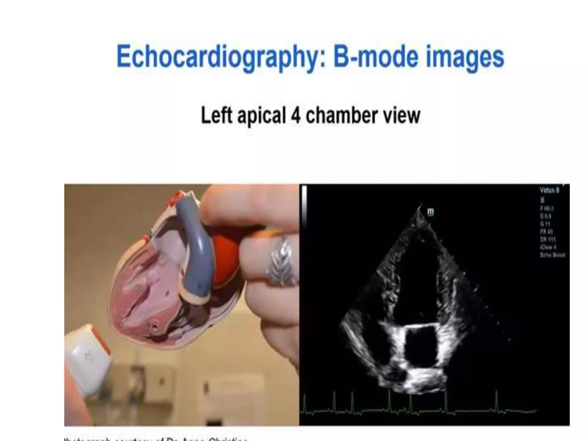 Canine Echocardiography -Dr Venkatesh S M.pptx