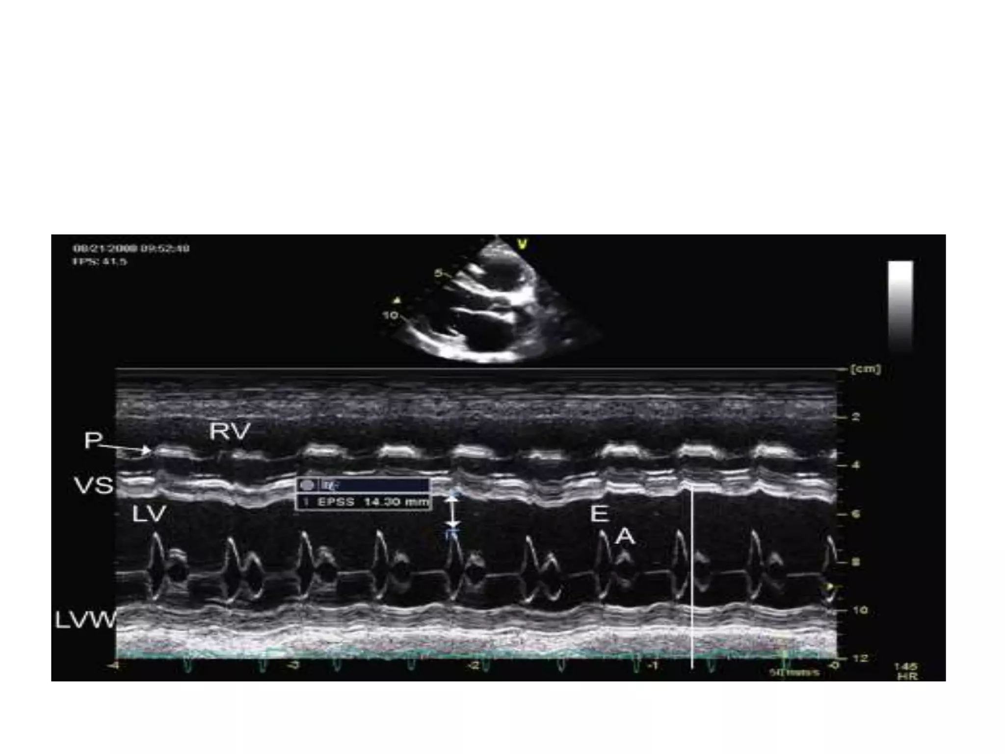 Canine Echocardiography -Dr Venkatesh S M.pptx