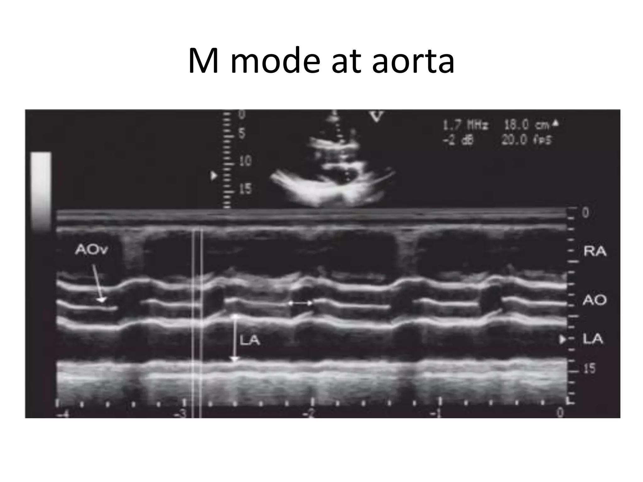 Canine Echocardiography -Dr Venkatesh S M.pptx