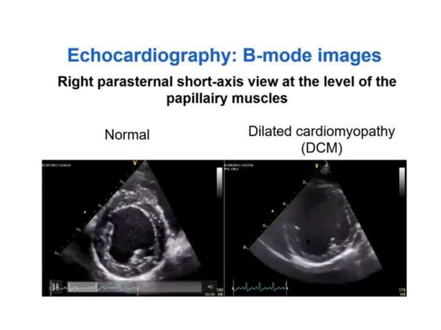 Canine Echocardiography -Dr Venkatesh S M.pptx