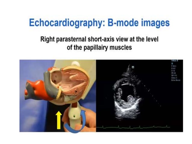 Canine Echocardiography -Dr Venkatesh S M.pptx
