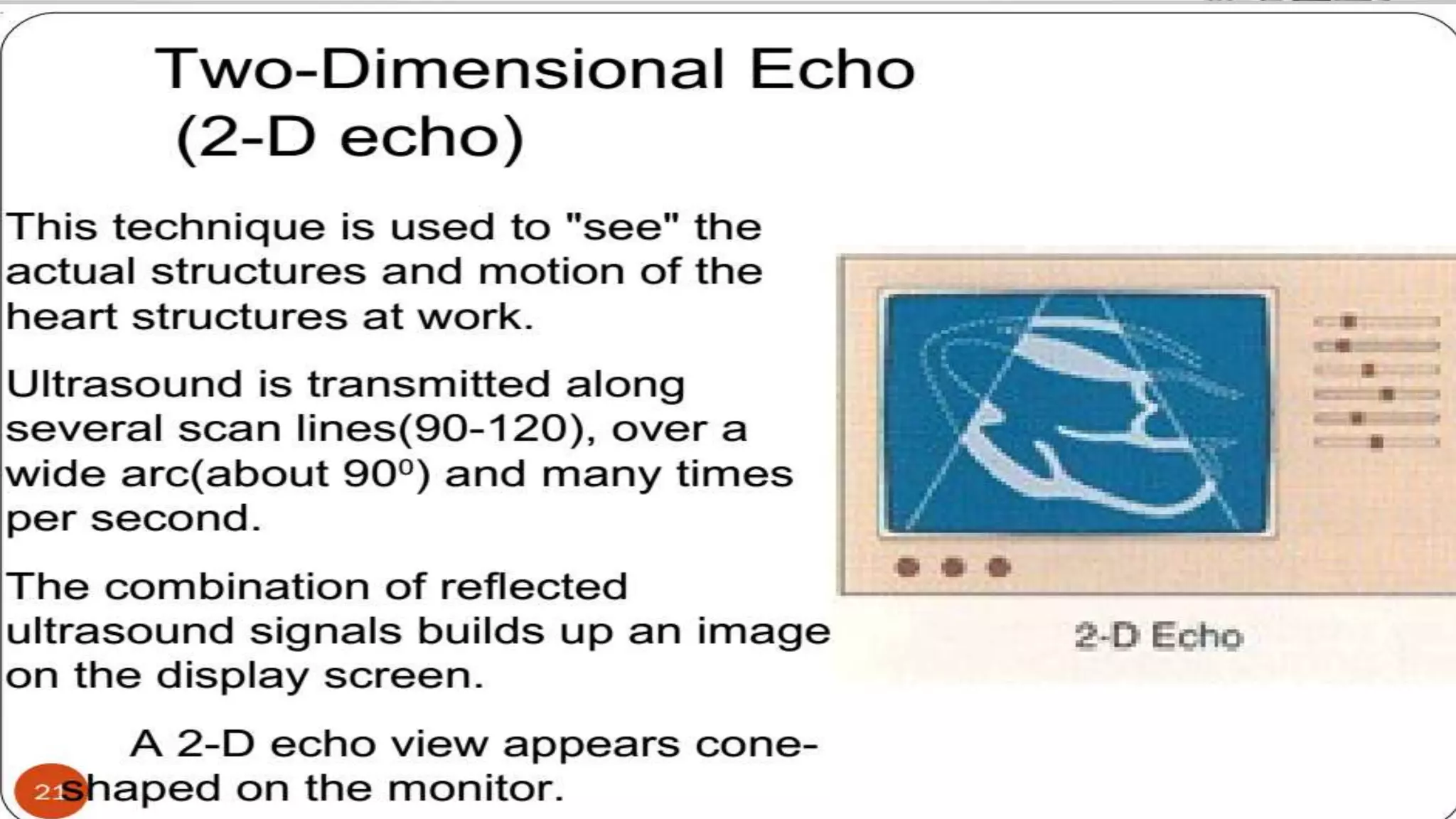 Echocardiography basics | PPTX | Heart and Cardiovascular Diseases ...