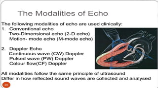 Echocardiography basics | PPTX | Heart and Cardiovascular Diseases ...