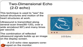 Echocardiography basics | PPTX | Heart and Cardiovascular Diseases ...