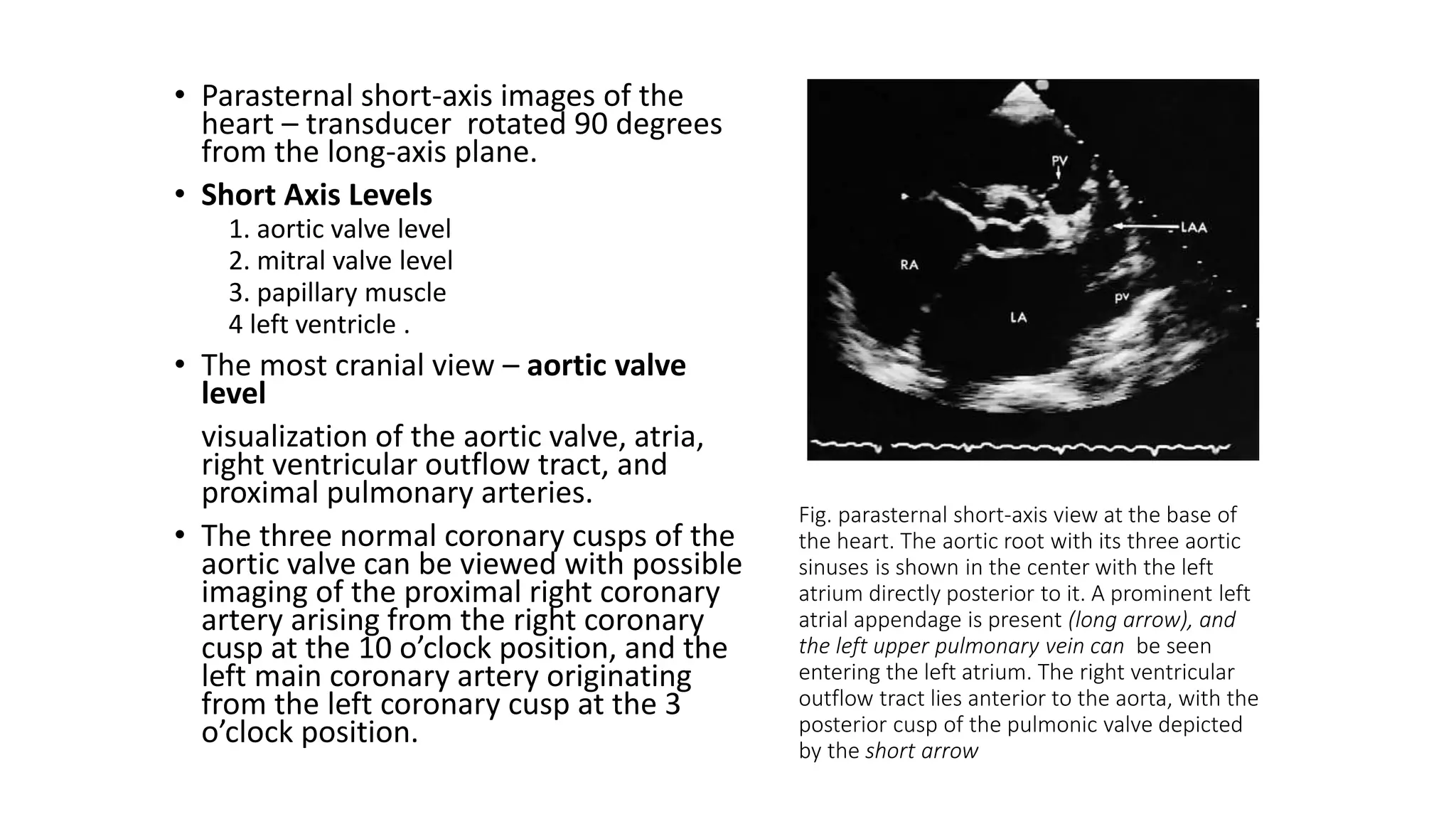 Echocardiography | PPTX
