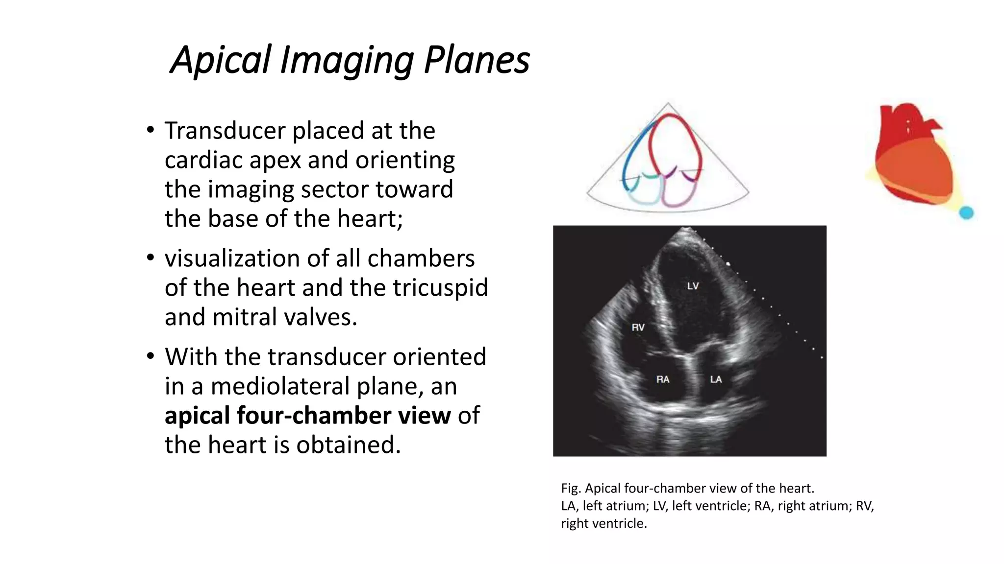 Echocardiography | PPTX