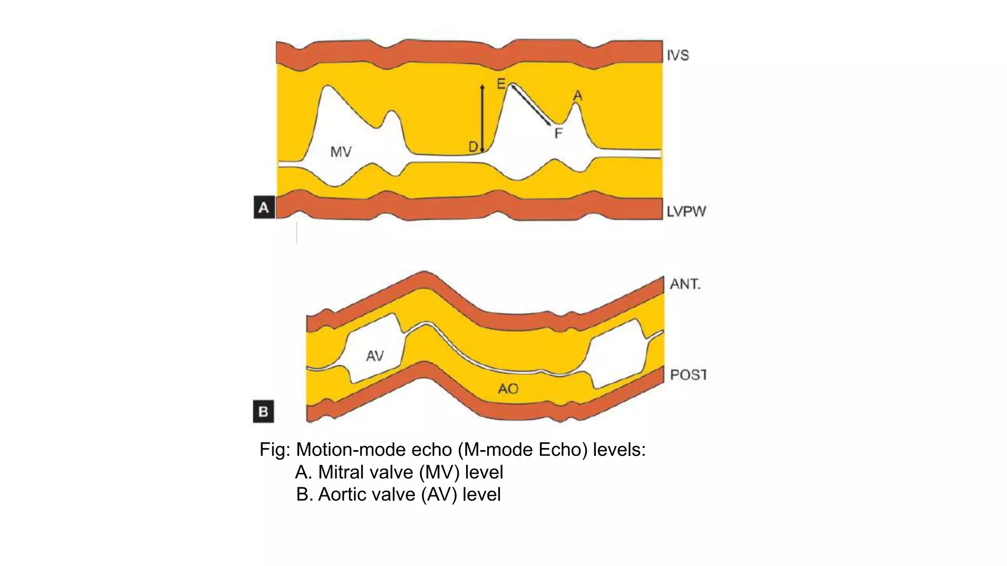 Echocardiography | PPTX