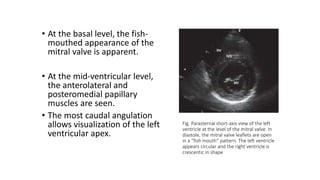 Echocardiography | PPTX