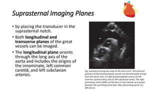 Echocardiography | PPTX