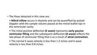 Echocardiography | PPTX
