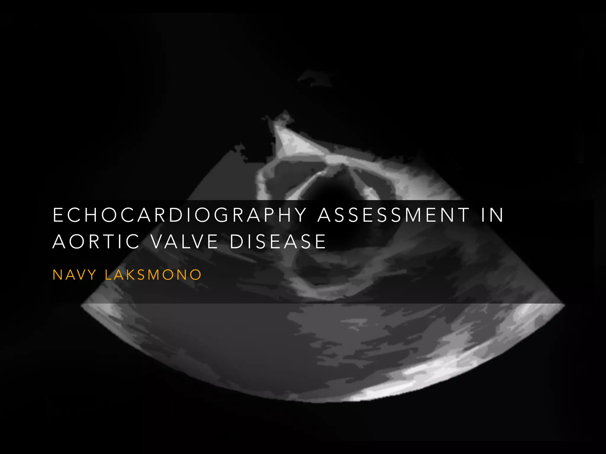 Echocardiography in aortic valve disease | PDF