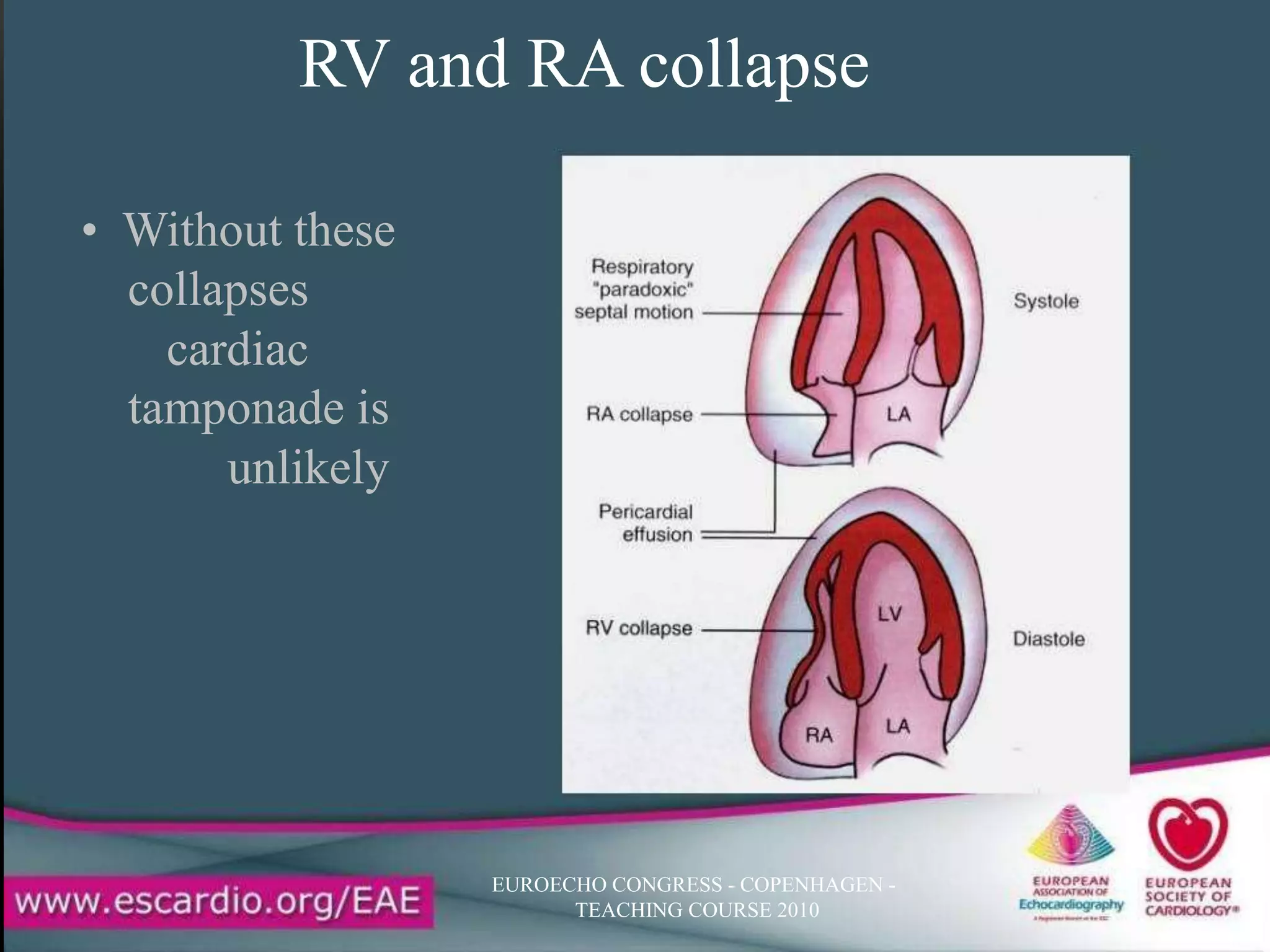 Echocardiography in cardiac emergency | PPTX
