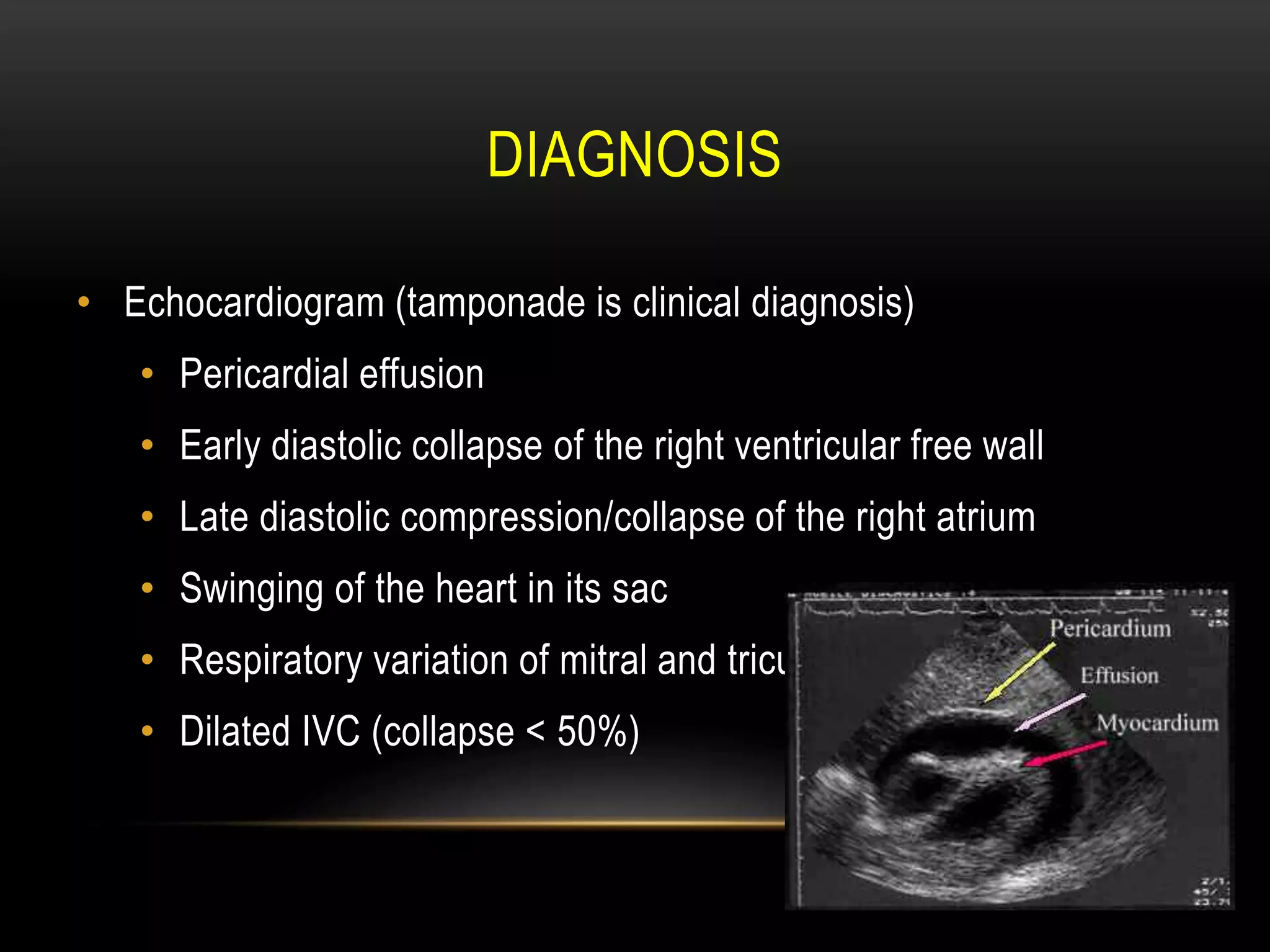 Echocardiography in cardiac emergency | PPTX
