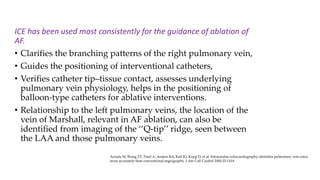 Echocardiography in intervention cardiology | PPTX
